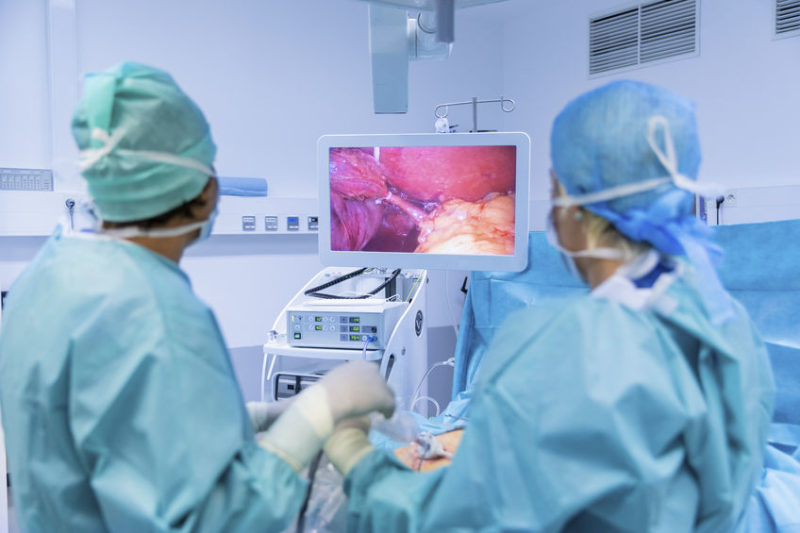 What Is An Endoscopy And Why Would My Doctor Order One? - Mackinaw ...